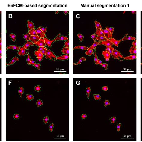 Examples Of Automated And Manual Segmentation Results A D Are Images