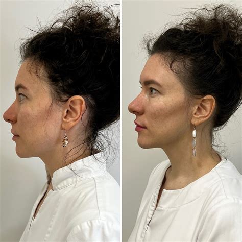 КОСМЕТОЛОГ МОСКВА КОЧКИНА НАТАЛИЯ Наши врачи постоянно следят за собой используют только