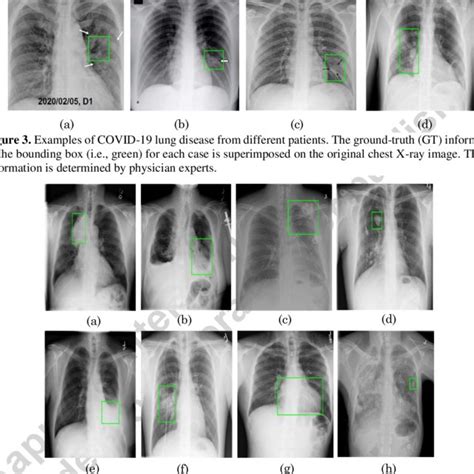 Schematic Diagram Of The Proposed Deep Learning Cad System Based On The