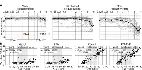 Figure 1 From Neural Adaptation At Stimulus Onset And Speed Of Neural Processing As Critical