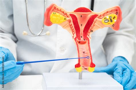 Doctor Holding Human Uterus Model For Vaginal And Cervix Pap Smear