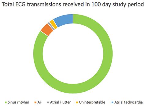 Total ECG Recordings Transmitted Via ECG Check Devices Over Days Download Scientific