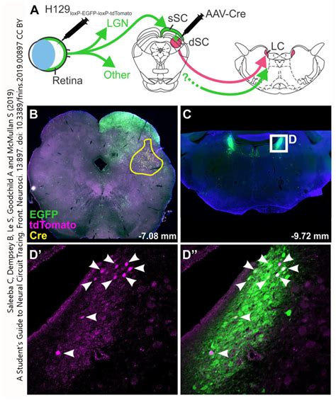 Axonal Transport And The Tracing Of Connections In The Brain Axonal Transport And The Tracing Of Connections In The Brain