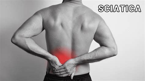 Managing Sciatica With Physical Therapy Reddy Care Physical