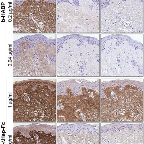 Histological Localization Of Ha In Formalin Fixed Paraffin Embedded