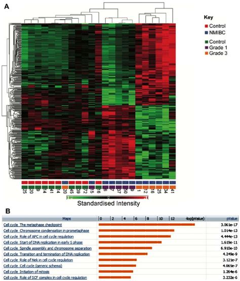 comparing grade 3 and 1 nmibc a hierarchical clustering segregates