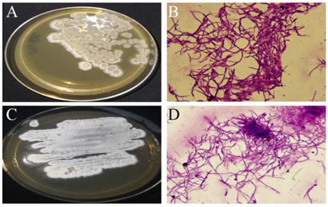 Exploring The Antimicrobial And Antioxidant Activities Of Streptomyces