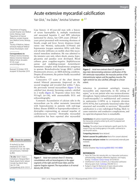 Pdf Acute Extensive Myocardial Calcification