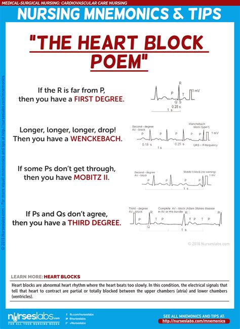 Heart Block Flow Chart Ponasa