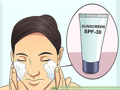 How To Reduce The Appearance Of Scars From Your Face Steps