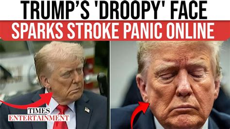 Trumps Face Shows Noticeable Droop At 911 Event Sparking Stroke