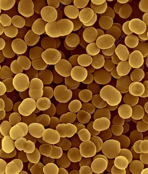 Moraxella Catarrhalis Diplococcus Sem Stock Image C032 2303