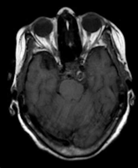 On The Case Radiology Today Magazine