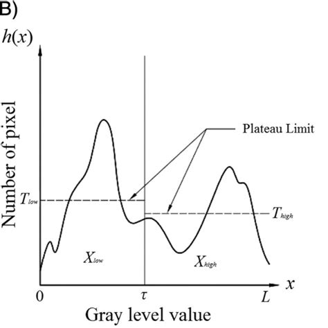 Brain Mri Image Histogram Equalization Result A Original Image B Download Scientific