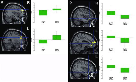 Functional Connectivity Between The Superficial Amygdala And Dorsal