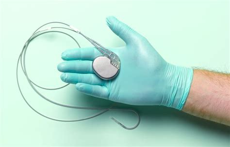 Pacemaker Surgery Preparation Recovery Long Term Care