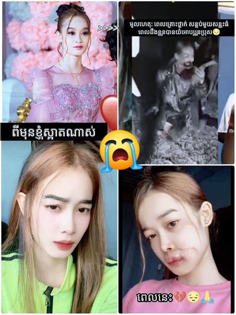 Ppn ឃើញបងប្អូនសួ រ ពី ប ញ្ហា មុ ខ គាត់ច្រើន តាមពិតគាត់ជួបគ្រោ