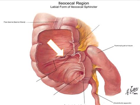 Soal Intestinum Tenue Et Intestinum Crassum Ppt