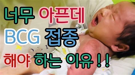 Bcg접종예방접종신생아피내용경피용 Youtube