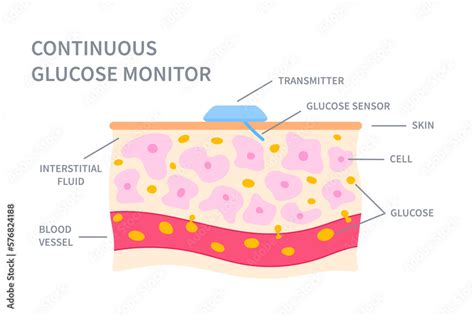 Continuous Glucose Sugar Monitor Glucometer Wireless Transmeter Cgm