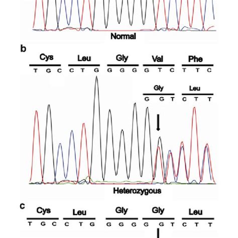 Electropherogram Of Normal A Heterozygous Affected B And Download Scientific Diagram