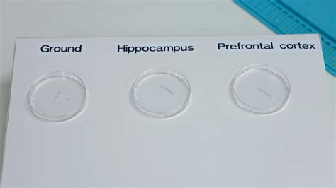 Video Electrode Fabrication For Recording Local Field Potentials In Mouse Hippocampus And