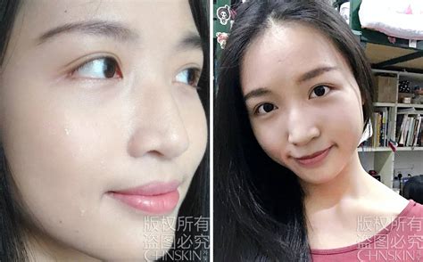 简单快速美白祛痘，出门自信不用“妆” 微信素材微信文章微信文章素材微信精选微助点素材库