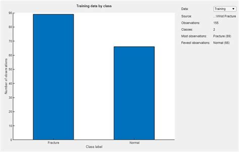 Proposed Wrist Fracture Prediction System Using Transfer Learning Download Scientific Diagram