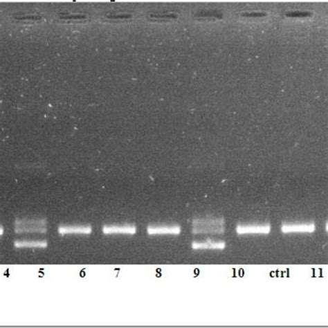 Pcr Product After Running Of The Gel For 1 Of The Ssr Primers Download Scientific Diagram