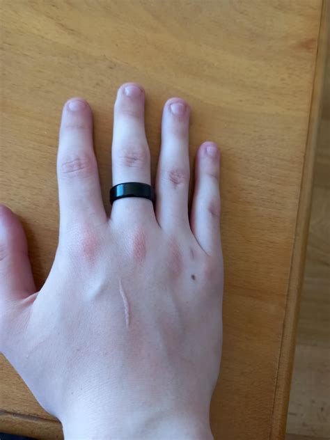 I Finally Got A Ring R Asexuality