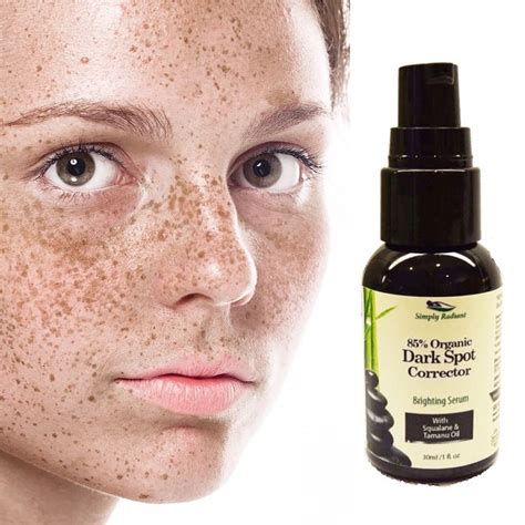 Best Dark Spot Treatment Korean At Sophia Linda Blog
