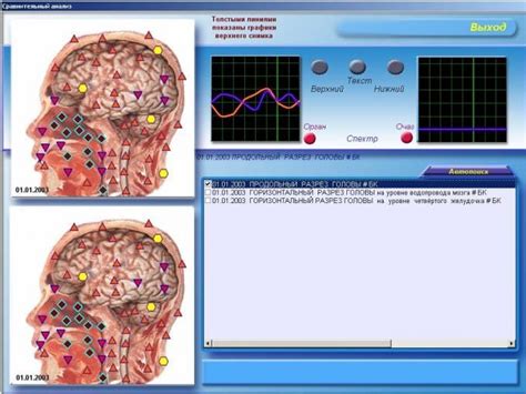 3d Nls Nonlinear Diagnostic System Maikong 3d Nls Health Analyzer 3d Nls Health Analyzer