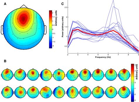 Figure 2 From Frontal Theta Eeg Activity Correlates Negatively With The