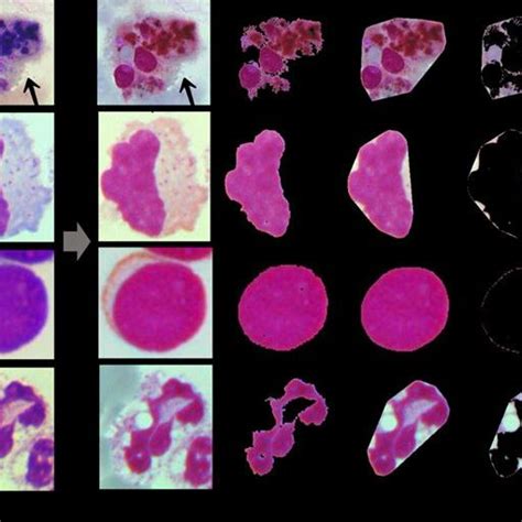 nuclear segmentation download scientific diagram