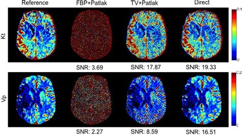 Figure 1 From Direct Estimation Of Permeability Maps For Low Dose Ct Perfusion Semantic Scholar
