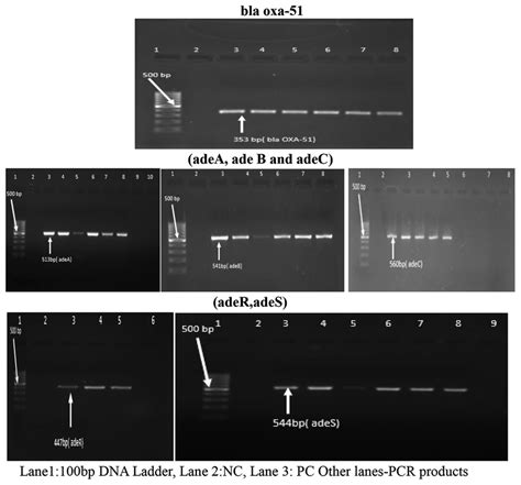 Gel Electrophoresis Results Of Bla Oxa 51 Efflux Pump Genes Adeabc Download Scientific