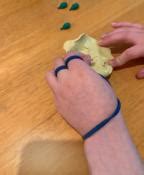 Functional Hand Splints An Easy DIY