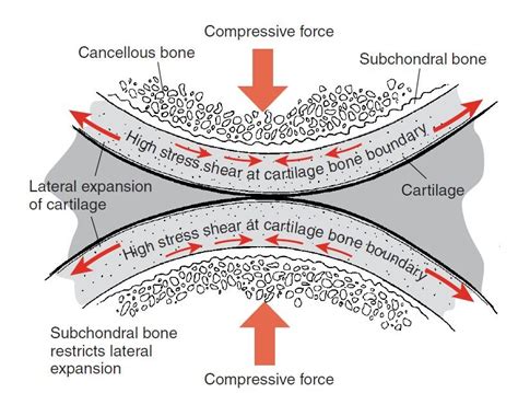 2 During Compressive Loading There Is A Large Lateral Displacement