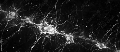 Apical Dendrite Structure Of Cortical Pyramidal Neurons With Spines And Bifurcation Revealed By