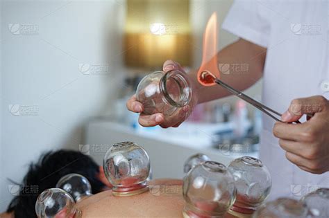 拔火罐