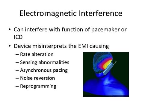 Basics Of Pacemaker Part 1 Dr Suresh S