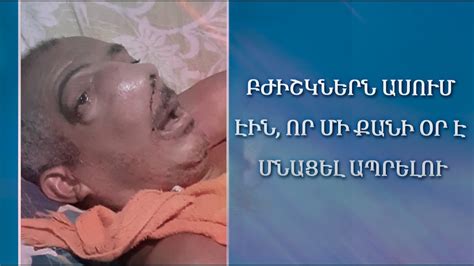 Բժիշկներն ասում էին որ մի քանի օր է մնացել ապրելու Անտոնիոյի վկայությունը Youtube