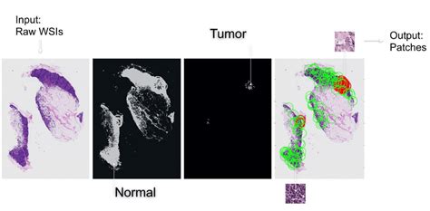 Wsis Preprocessing Pipeline Normal Tissue And Tumor Tissue Masks Are