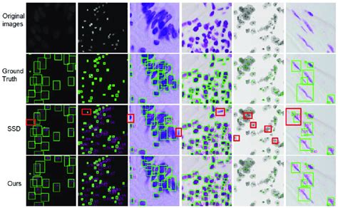 Effects Of The Detection Module On Kaggle 2018 Data Science Bowl The Download Scientific