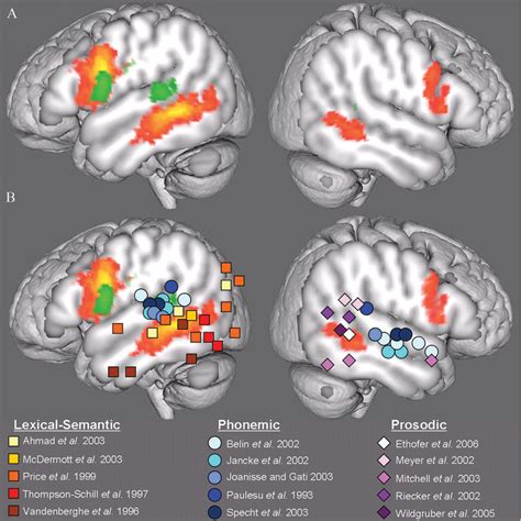 Figure 1 From Dti Tractography Of The Human Brains Language Pathways