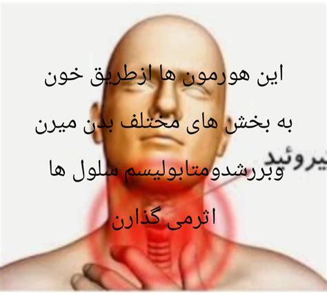 اختلالات غده تیرویید