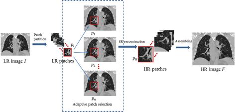 Overview Of Our Adaptive Patch Based Method For Super Resolution Download Scientific Diagram