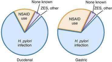 Peptic Ulcer Disease Clinical Gate