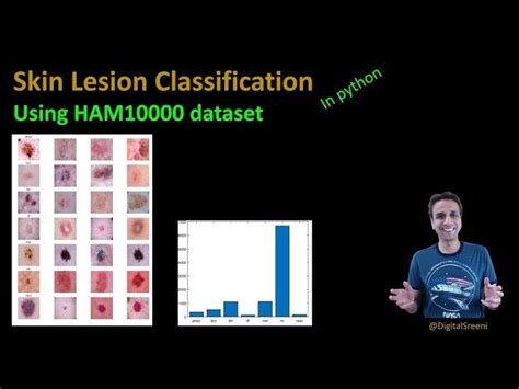 Free Video Skin Cancer Lesion Classification Using The Ham10000