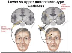 Lab 4 Cranial Nerve Testing Quizlet